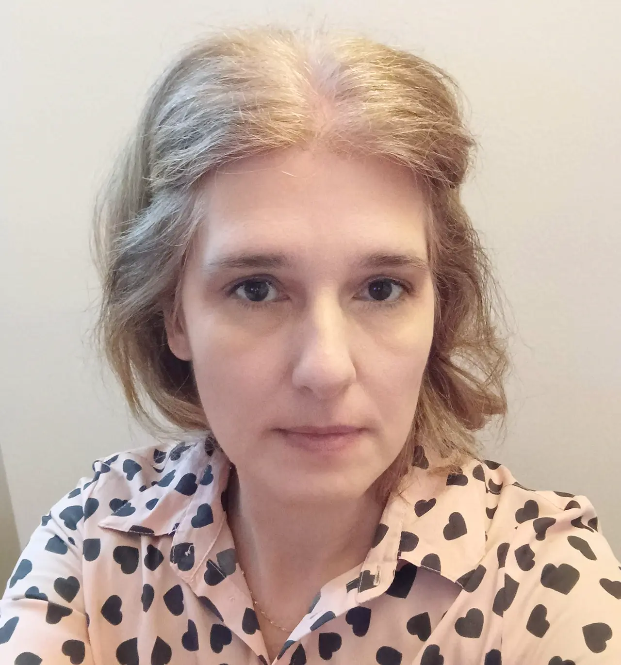 About - Quality vision